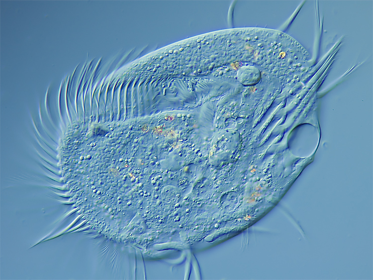 Euplotes - www.photomacrography.net