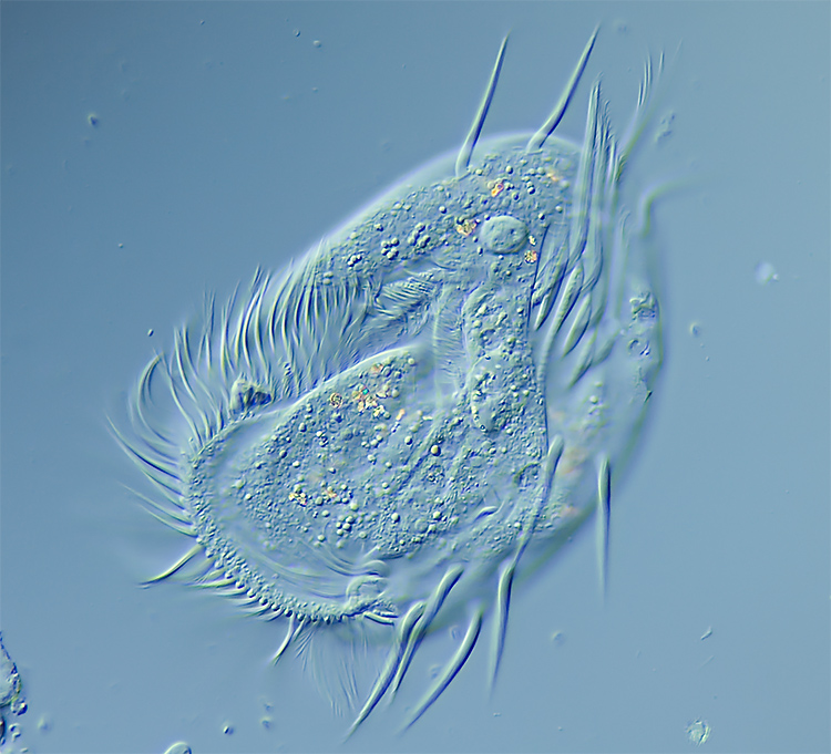 Euplotes - www.photomacrography.net